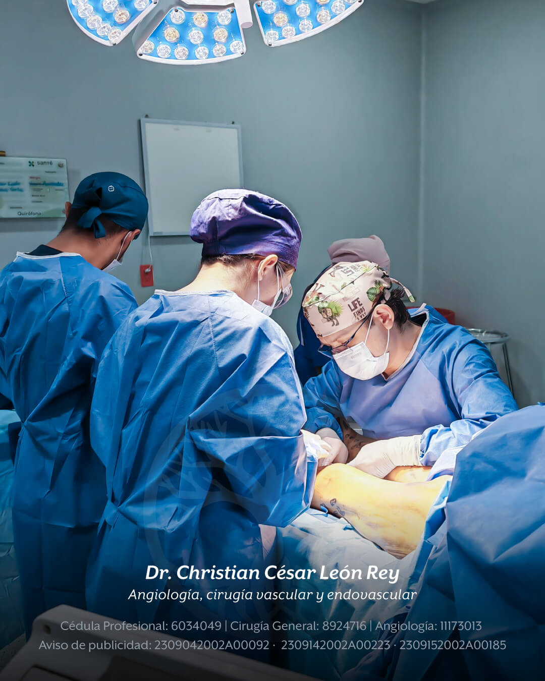 Todo sobre las várices - Dr. Christian César León Rey